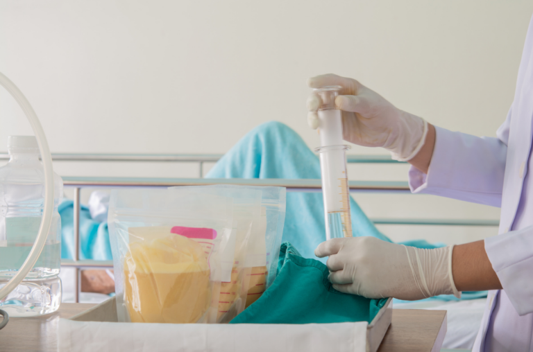 All You Need To Know About PEG Feeding