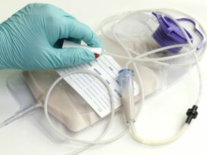 All You Need To Know About PEG Feeding