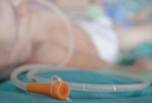 PEG Feeding Workshop | DP Training Australia